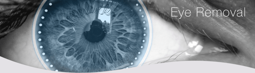 Eye Removal - Eyecare Virginia Beach